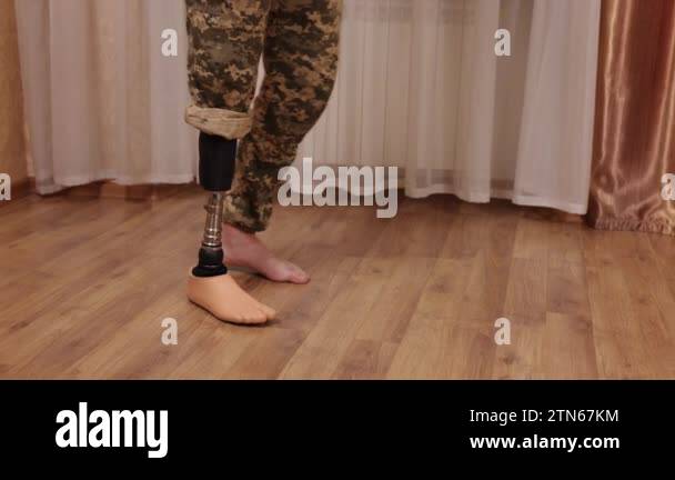Phantom limb, Amputee rehabilitation, Combat injury. A soldier who was ...