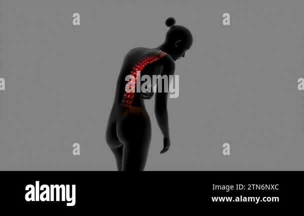 Back Pain spinal spine close-up animation Anatomy female Body 3D Scan ...