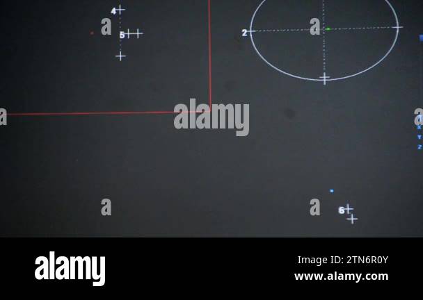 Utrasound image on the monitor close-up. Ultrasound Scan display ...