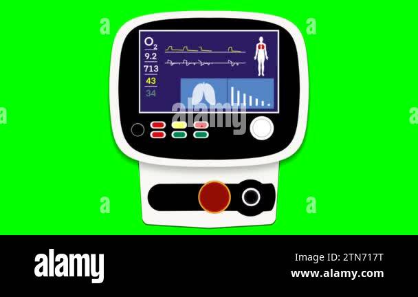 ventilator monitor, Monitoring During Mechanical Ventilation, monitor ...