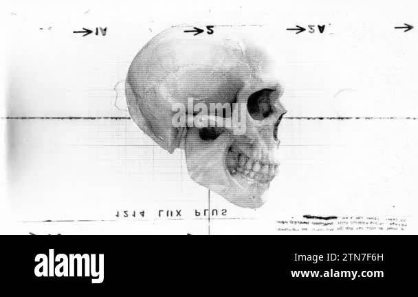 A looping old film and medical chart style graphic of a spinning skull ...