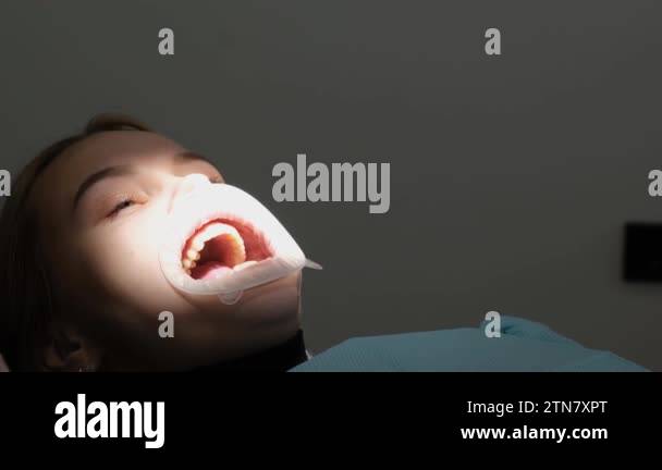 Female patient with open mouth during dental treatment. Capa during ...