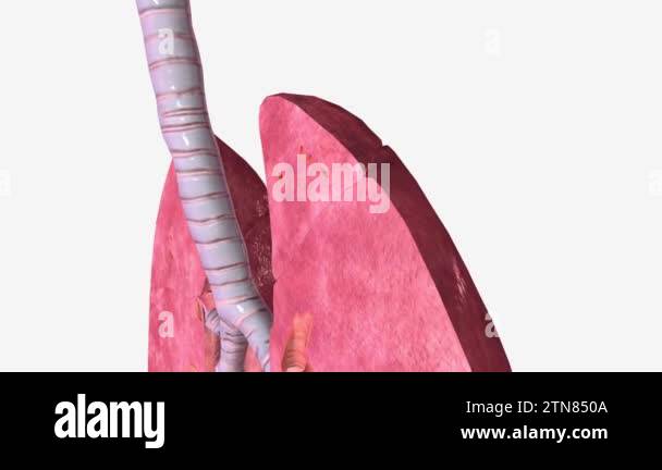 Lungs Coronal Cross Section Left inferior lobe Stock Video Footage - Alamy