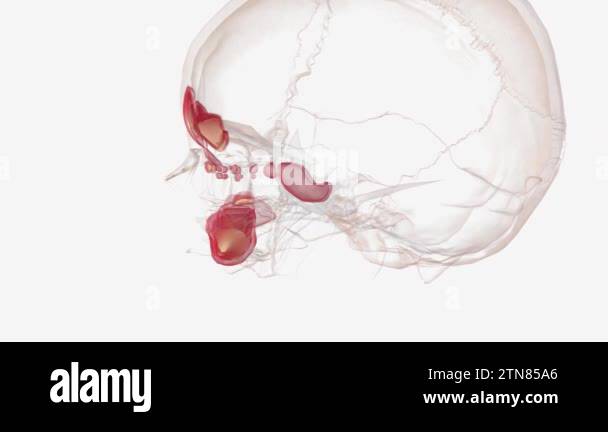 Sinusitis is an inflammation, or swelling, of the tissue lining your ...