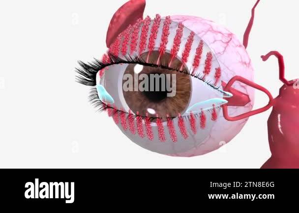 Blepharitis is a common eye condition that makes your eyelids red ...