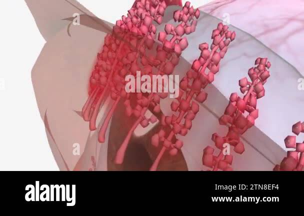 Blepharitis/MGD refers to low-grade inflammation of the eyelids and ...