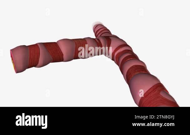 Bronchial asthma (or asthma) is a lung disease. Your airways get narrow ...