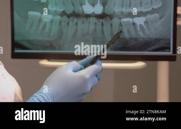 Closeup dentist hands sterile glove hold green screen cellphone at ...