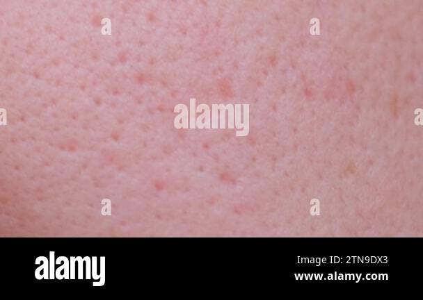 Skin type treatment Stock Videos & Footage - HD and 4K Video Clips - Alamy