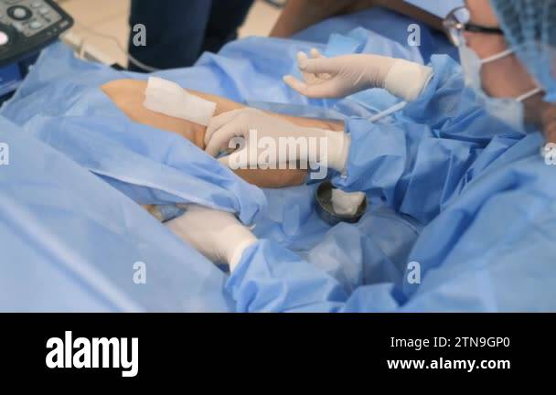Surgical operation on the leg for varicose veins. A surgeon performs an ...