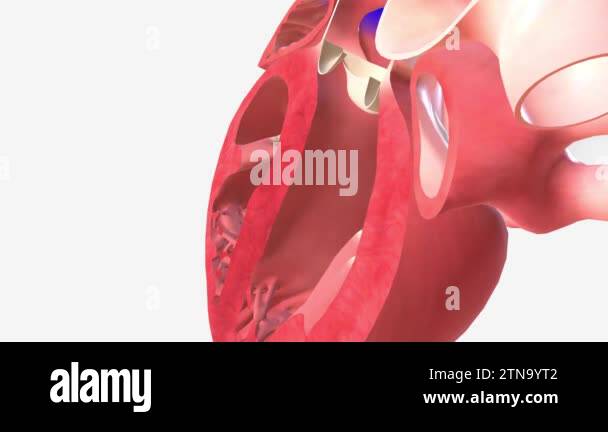 Deoxygenated blood from the lower half of the body enters the heart ...