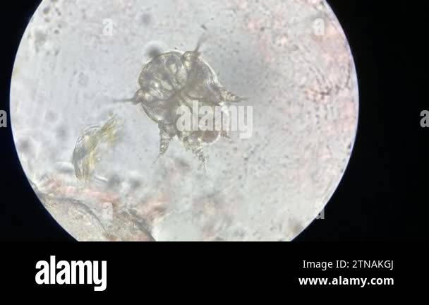 Notoedres cati under the microscope. Notoedric mange, also referred to ...