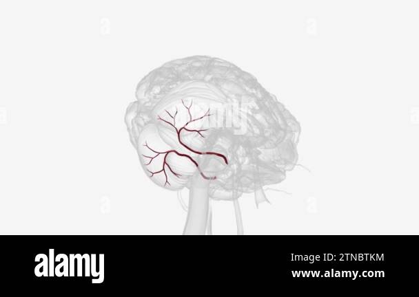Posterior inferior cerebellar artery (PICA) is one of the three vessels ...