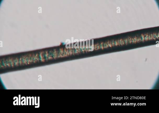 Single Human hair under a microscope. Microscopy of human hair from the ...