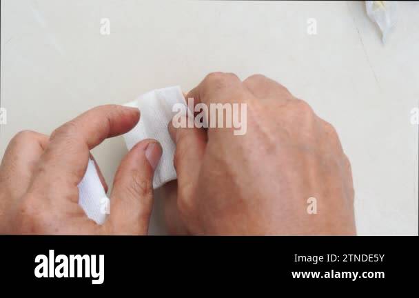 clean the wound On the feet of a man from an accident at home isolated ...
