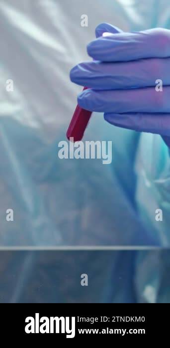 Vertical video. Complete blood count. Diagnostic testing. Microbiology ...