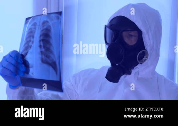 Lungs affected by radiation, chemical effects on the respiratory tract ...