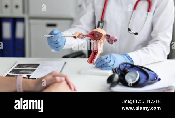 Doctor gynecologist showing patient female diseases on model of uterus ...