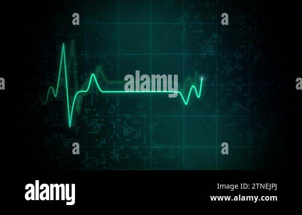 Electrocardiogram heartbeat. Display on the monitor of the pulse line ...