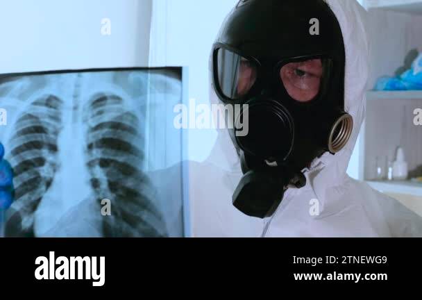 Radioactive damage to the lungs on X-ray in the laboratory. A worker in ...