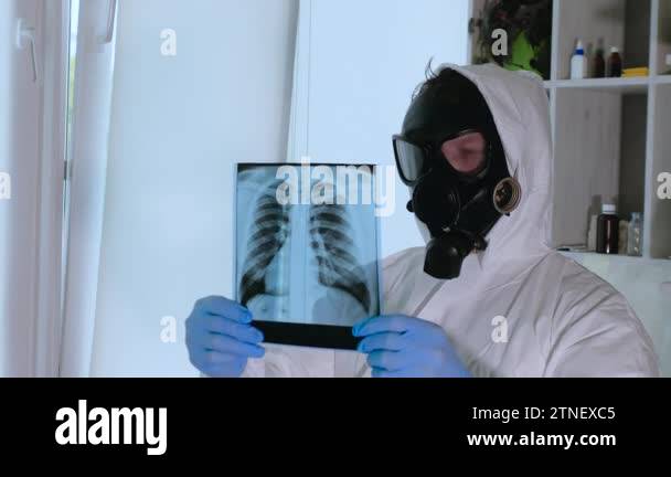 Radioactive effects on the respiratory tract on x-ray of the lungs. A ...