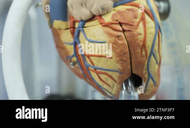Artificial circulation of blood, mans artificial heart, model of the ...