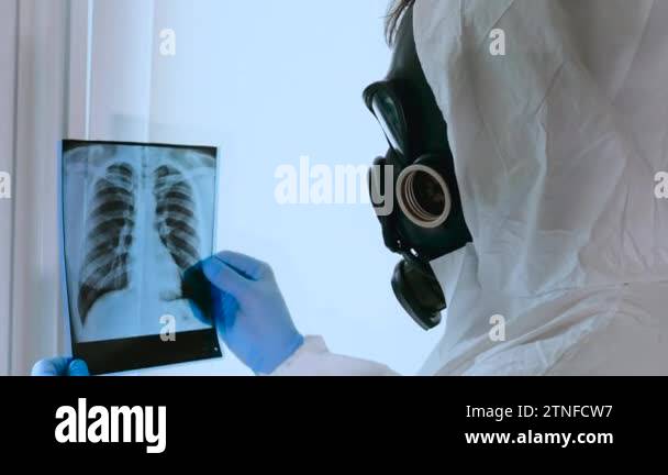 Radioactive damage to the lungs on X-ray in the laboratory. A worker in ...