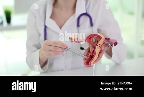 Female specialist demonstrates model of artificial uterus at clinic ...