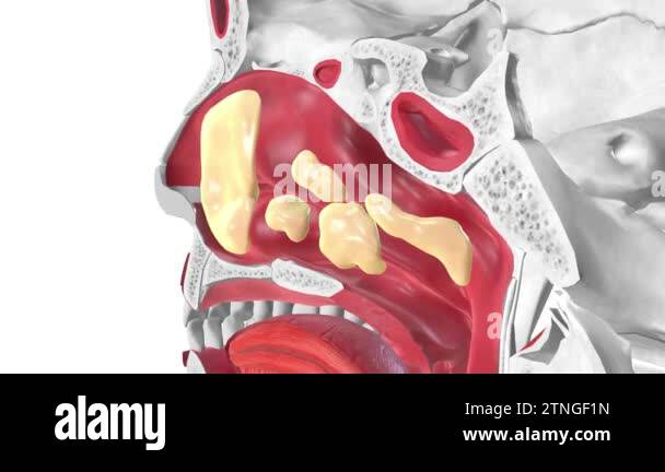 Mucus is a slippery aqueous secretion produced by, and covering, mucous ...