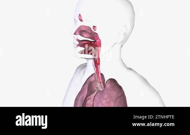 Croup is a childhood condition that affects the windpipe (trachea), the ...