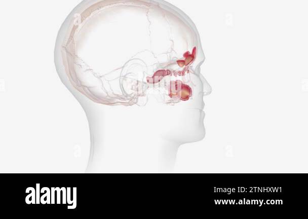 Sinusitis is an inflammation, or swelling, of the tissue lining your ...