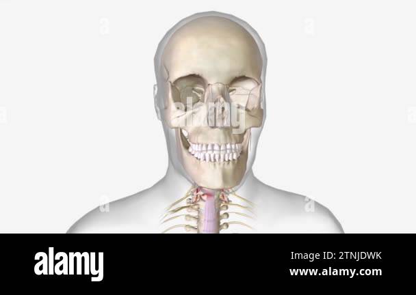 Subaxial Cervical Vertebral Body Fractures are a subset of cervical ...