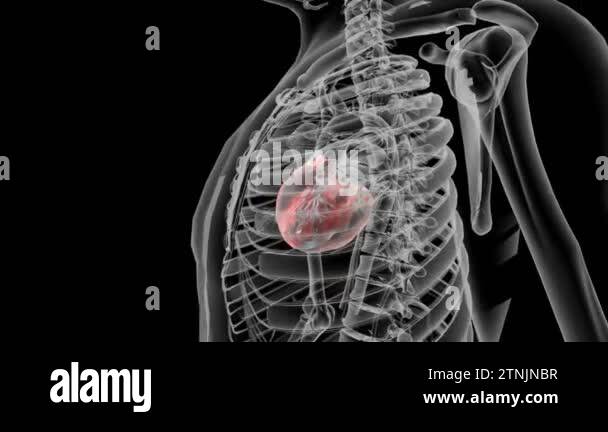 Cardiac Fat. There are 3 major fat depots around the heart: pericardial ...