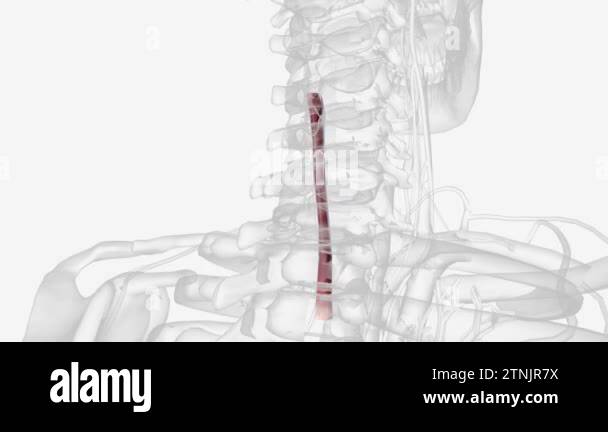 The left common carotid artery arises from the aortic arch within the ...