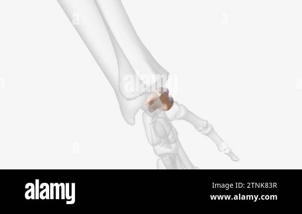 The scaphoid bone is one of the carpal bones on the thumb side of the ...