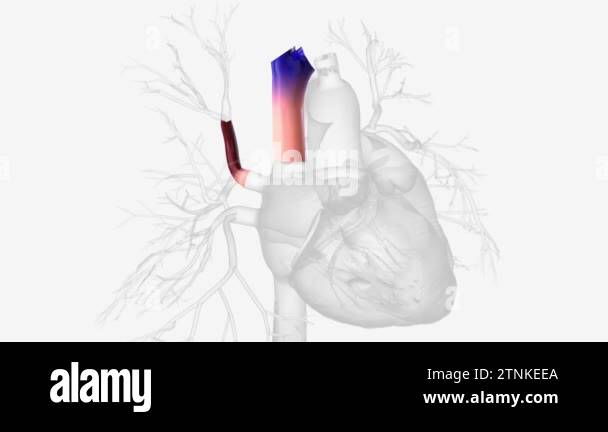 Pulmonary thrombosis Stock Videos & Footage - HD and 4K Video Clips - Alamy