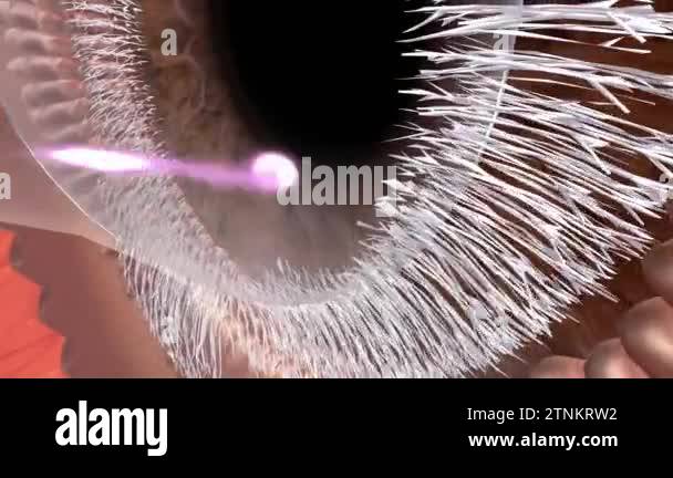 Blepharitis Is A Common Eye Condition That Makes Your Eyelids Red Swollen Irritated And Itchy