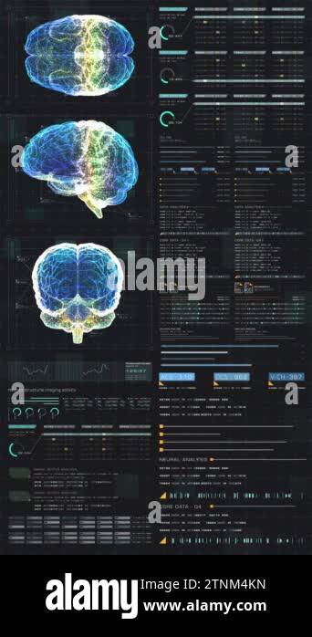 Head neuron Stock Videos & Footage - HD and 4K Video Clips - Alamy