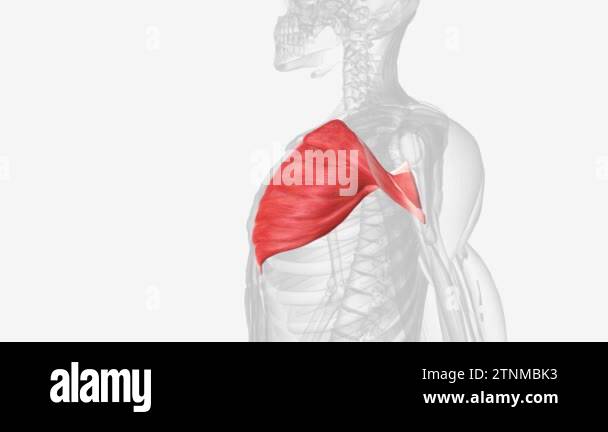 A pectoralis major strain refers to a tear in the large muscle which ...