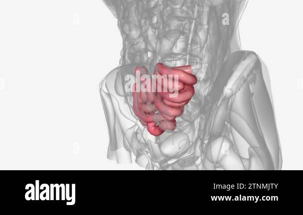 Ileum, the final and longest segment of the small intestine Stock Video ...