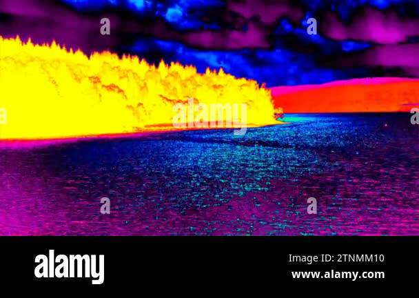 Gamma camera scan Stock Videos & Footage - HD and 4K Video Clips - Alamy
