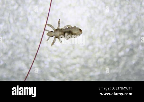 Head louse walking on white bumpy surface bellow human hair. Extreme ...