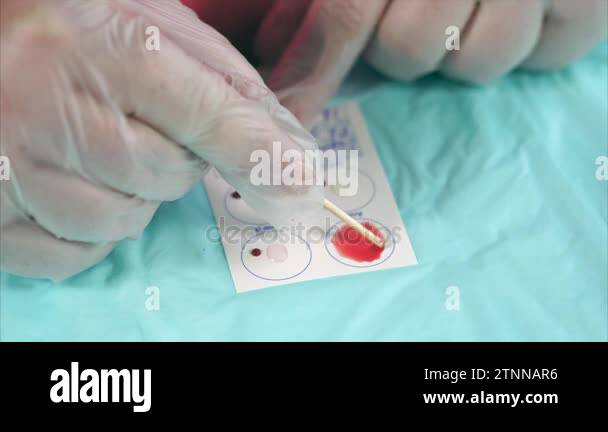 Blood panel Stock Videos & Footage - HD and 4K Video Clips - Alamy