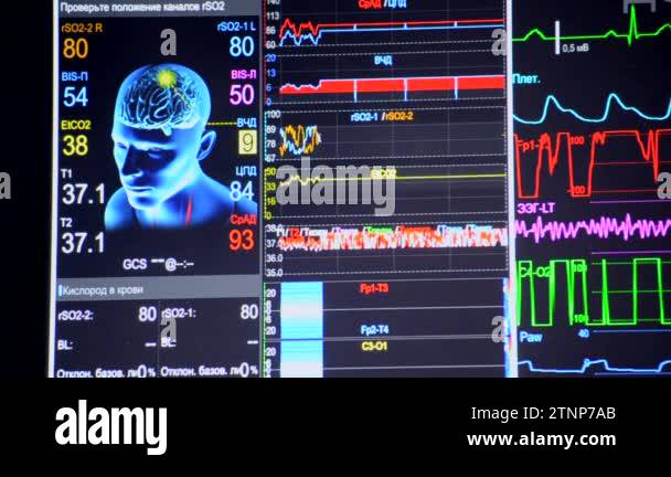 Patient monitor close-up. Monitor with different patient vital signs in ...