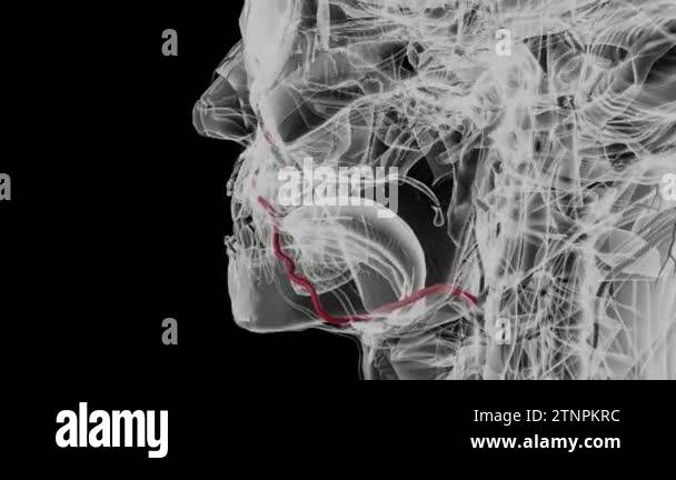 The facial artery (external maxillary artery in older texts) is a ...