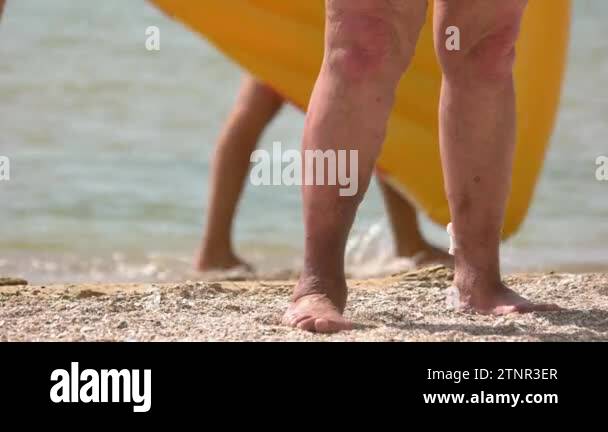 Close up ugly legs of retired old granny with varicosis. Woman with ...