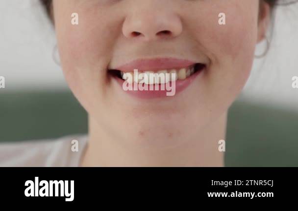 Teeth with or without braces Stock Videos & Footage - HD and 4K Video ...