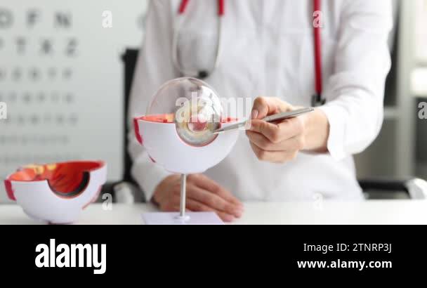 Ophthalmologist shows structure of human eye on model. Eye function ...