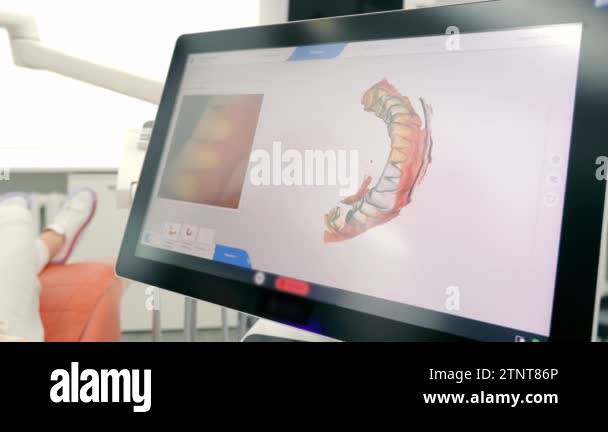 Looking at the screen and scanning the dental jaw in 3D space. Modern ...