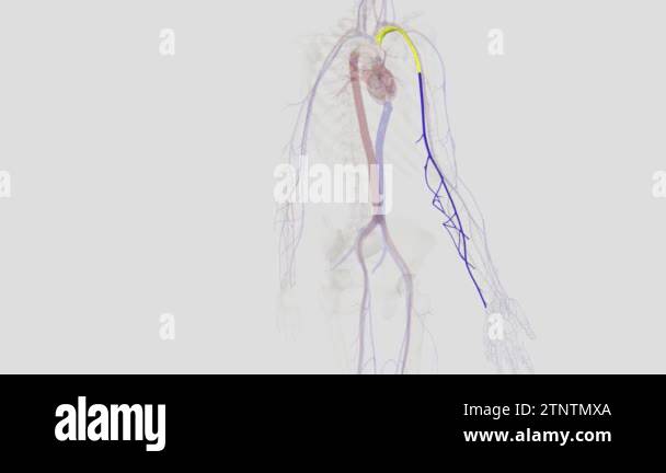 The basilic vein is a large superficial vein of the upper limb that ...